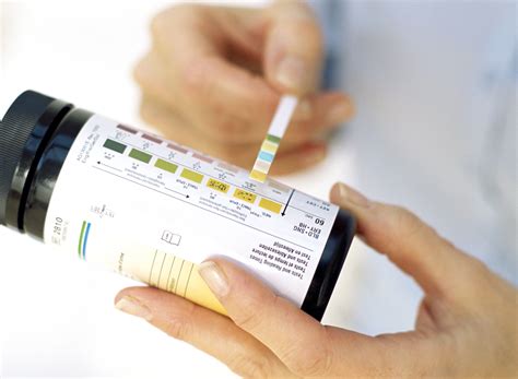 Urine Ketone Test Purpose How To Buy Strip Results