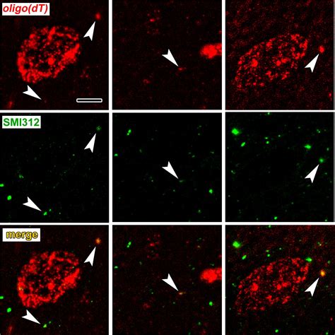 Figures And Data In Axon TRAP Reveals Learning Associated Alterations