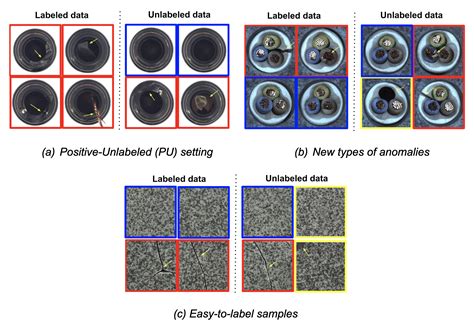 Unsupervised And Semi Supervised Anomaly Detection With Data Centric Ml