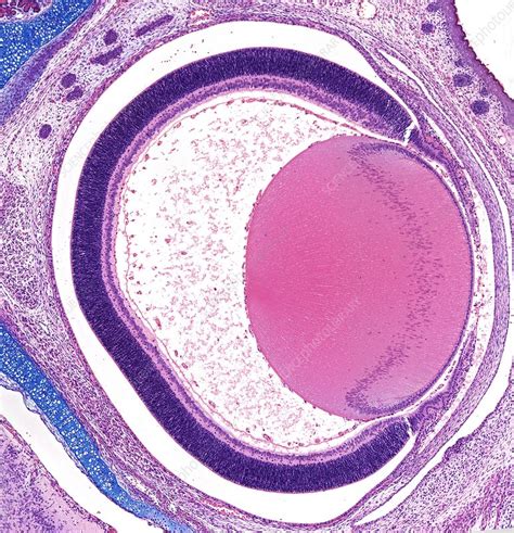 Fetal Eye Light Micrograph Stock Image C0239446 Science Photo