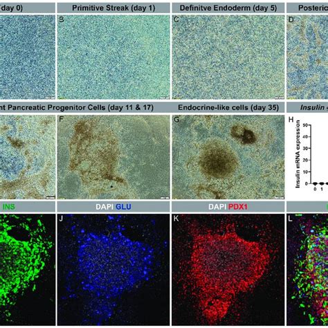 Differentiation Of Human Ipscs Into β Like Cells A G Progression Download Scientific