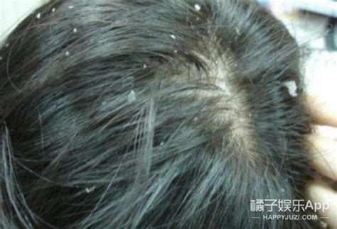 湿着头发就睡觉危害健康的坏习惯你还敢做吗 360娱乐你开心就好