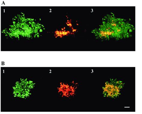Bi Directional Differentiation Of E145 Dlk Cells Ab Typical