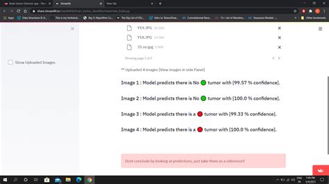 Brain Tumor Detector App Show The Community Streamlit