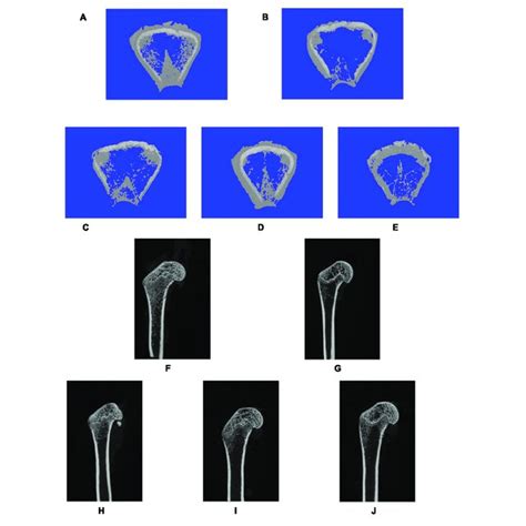 Micro Ct Analysis Of A Bmd Bone Mineral Density B Bsbv Bone