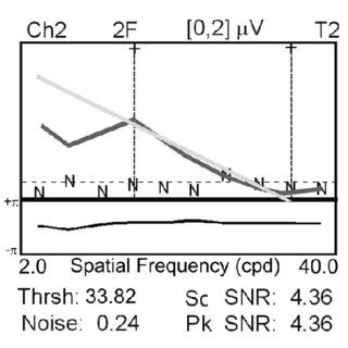 A Sample Of Individual Visual Evoked Potential VEP Amplitude Versus Download Scientific
