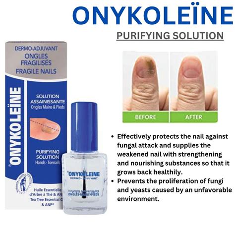 ONYKOLEINE FUNGUS SOLUTION 10ml, Beauty & Personal Care, Hands & Nails ...
