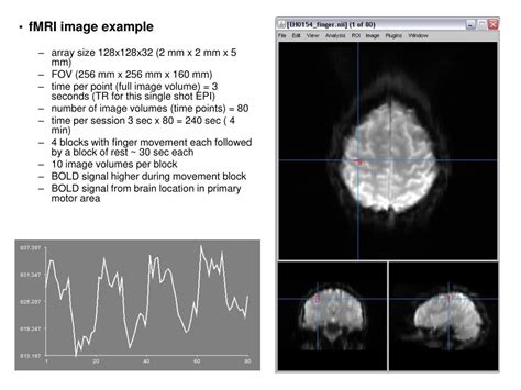 Ppt Statistical Parametric Mapping Powerpoint Presentation Free