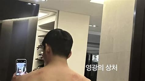 آپدیت ویورس تهیونگ زخم افتخار نماشا