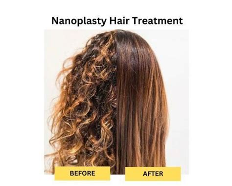 What Is Nanoplasty Full Guide With All Details Fabbon 42 Off