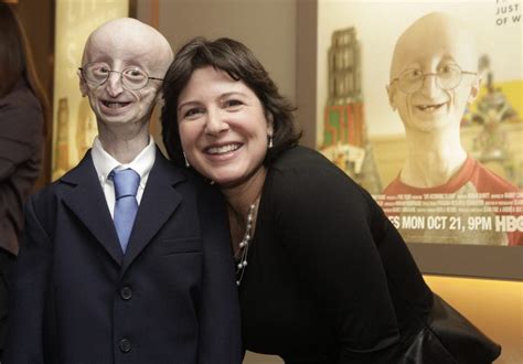 10 Rare Genetic Disorders Facty Health