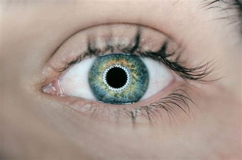 Esotropia Vs Exotropia A Comprehensive Guide