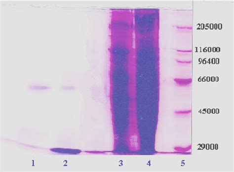 Figure 1 From Purification And Characterization Of Catalase Enzymes