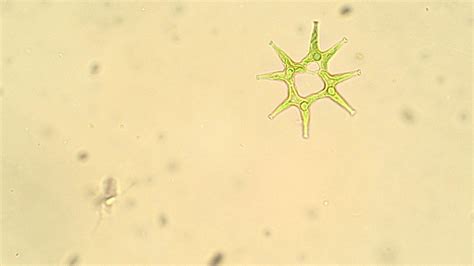 Algea Instance Segmentation Model By Yolo V8