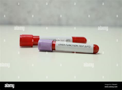 Liver Function Test Tubes With Blood Samples On White Table Stock