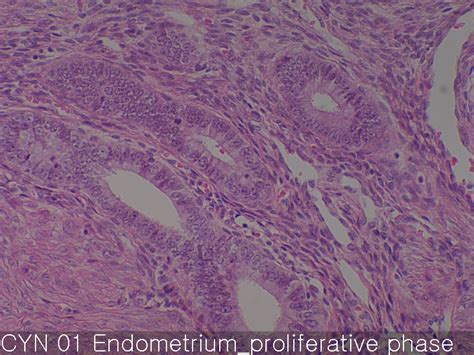 Normal Endometrium Xelonet