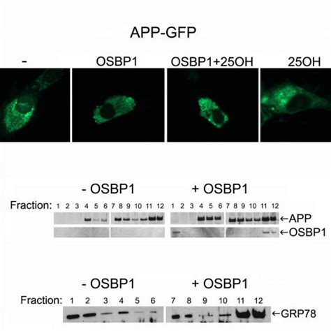 Subcellular Localization Of Total App Was Not Affected By Osbp1