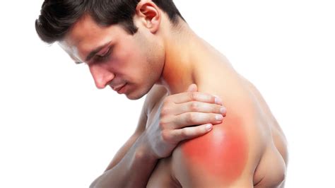 Calcific Tendinitis Causes Symptoms And Treatment Options Freedom Clinics