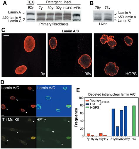 Lamin A Dependent Nuclear Defects In Human Aging Science