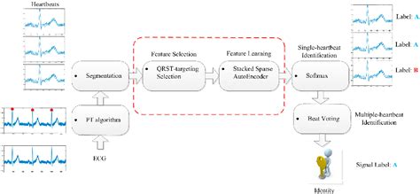 Figure 1 From A Novel Electrocardiogram Biometric Identification Method Based On Temporal