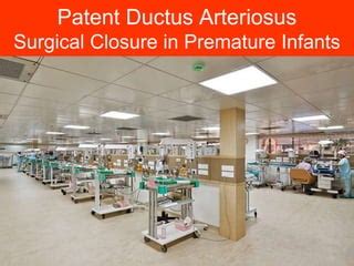 Surgical Closure Neonatal PDA PPTX Heart And Cardiovascular Diseases Diseases And Conditions