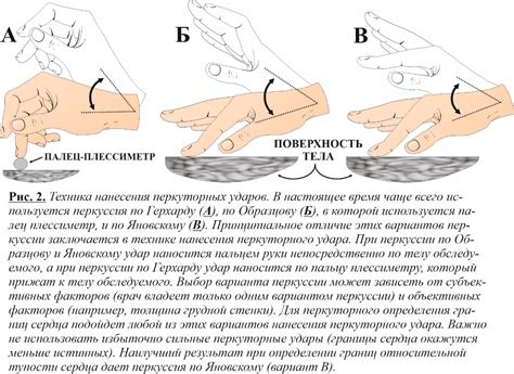 Лекция 08 (Клиническая топография сердца)
