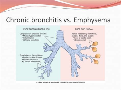 Respiratory Diseases Obstructive Lung Diseasesppt