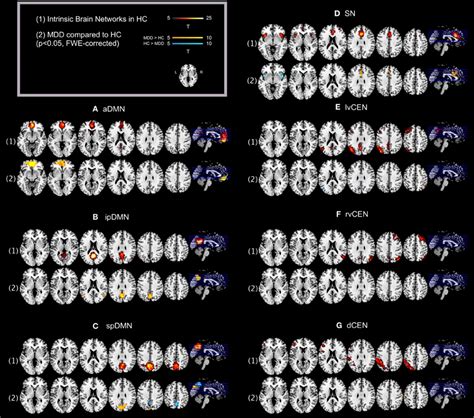 Default Mode Network Salience Network And Central Executive Network
