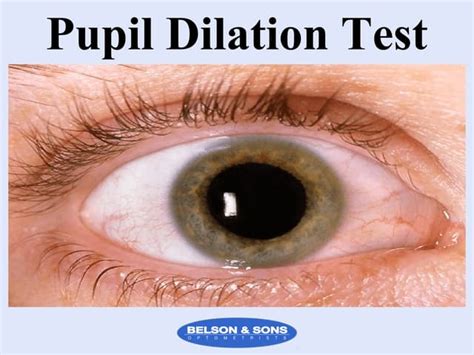 Pupil Dilation Test Ppt