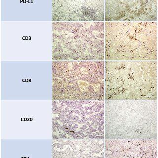 Photomicrographs Of FFPE Tissue From Primary And Metastatic Lesions Download Scientific Diagram