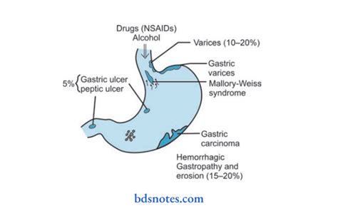 Gastrointestinal Diseases Important Question And Answers BDS Notes