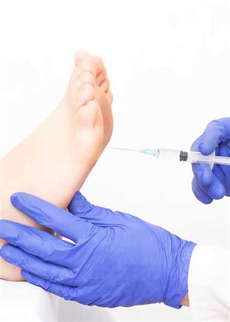 Plantar Hyperhidrosis Foot Sweating California Institute For