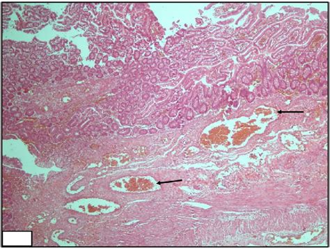 Photomicrograph Of Histology H And E Stain 40x Showing Abnormal