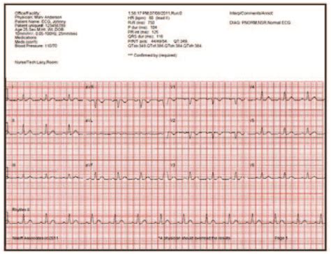 Nasiff Cardioresting Pc Based Ecg System Cc Ecg1