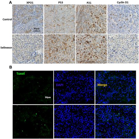 Selinexor Affected The Expression Of Xpo1 P53 P21 Cyclin D1 And Cell
