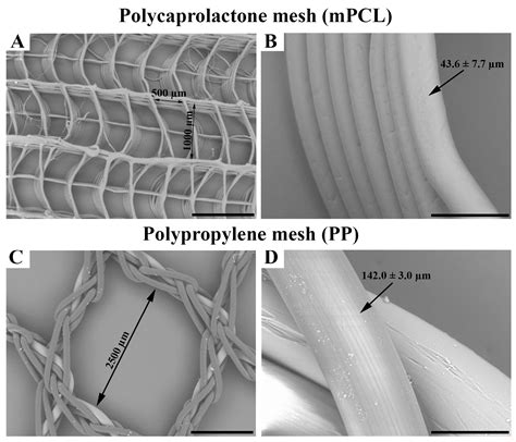3d Printed Medical Grade Polycaprolactone Mpcl Scaffold For The