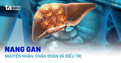 B Nh Nang Gan C Nguy Hi M Kh Ng Nh H Ng S C Kh E G Kh Ng