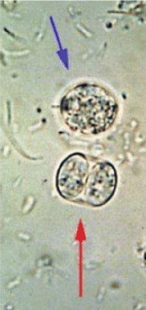 Toxoplasma Gondii Introduction Classification History Habitat Morphology Culture