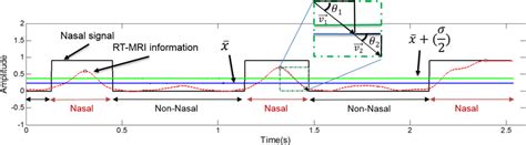 Exemplification Of The Emg Signal Segmentation Into Nasal And Non Nasal Download Scientific