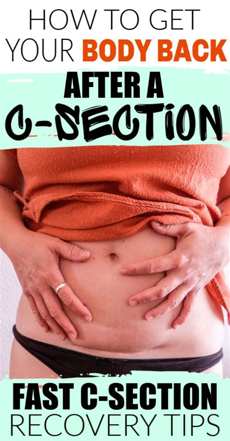 C Section Recovery Tips Italianpolishmomma Com C Section Recovery C Section C Section Workout