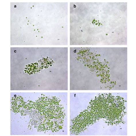 Pdf Flocculation Characteristics Of A Bioflocculant Produced By The Actinomycete On Microalgae
