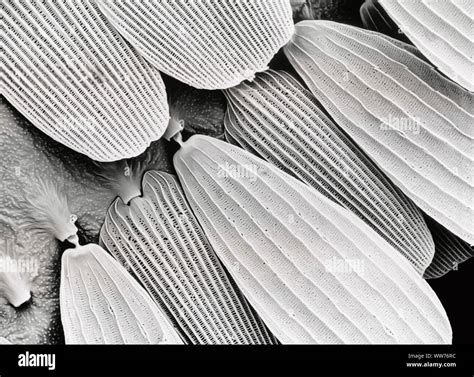 Scanning Electron Microscope Of Magnification At Steve Michelle Blog