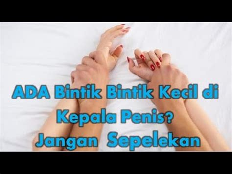 ADA Muncul Bintik Bintik Kecil Di Kepala Penis Jangan Dianggap Sepele YouTube