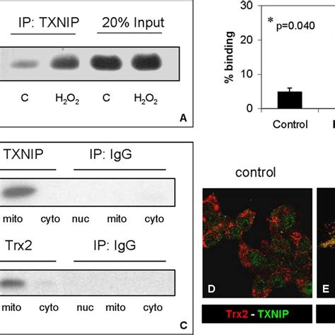 Shuttling Of Txnip Into The Mitochondria In Response To Oxidative Download Scientific Diagram