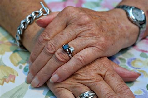 Age Spots Or Melanoma What S The Difference And How To Tell