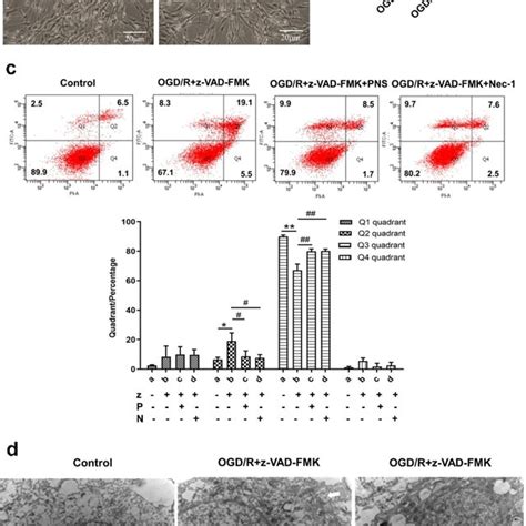 The Effect Of Pns On Rip1 Rip3 Mlkl Signaling Pathway In Ogd R In Download Scientific Diagram