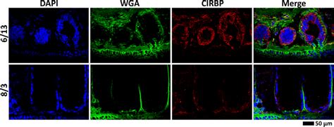 Cirbp Immunohistochemistry Comparison Of Cirbp Expression And