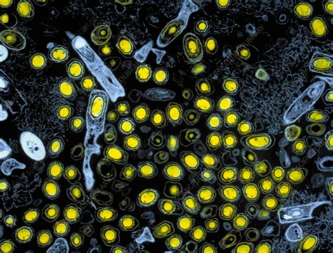 Anthrax Bacteria Light Micrograph Stock Image B2201385 Science