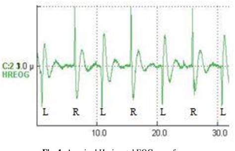 Figure 1 From Robotic Control By Eog Eeg Rfid Based Multimodal Interface And Shared Control