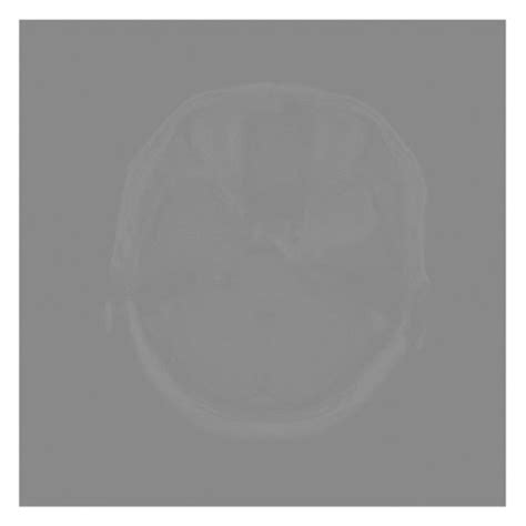 Mri Before And After Normalization Download Scientific Diagram